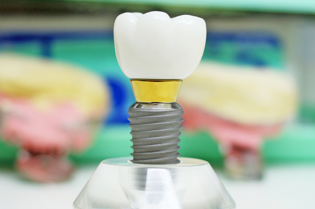 Services – Dr Smile